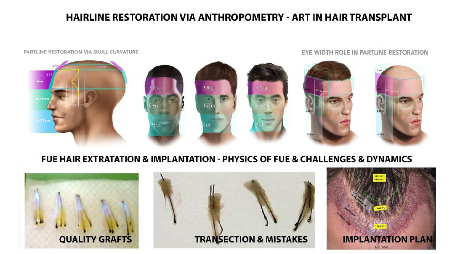 All About Hair Transplant – Fidore Health Blogs